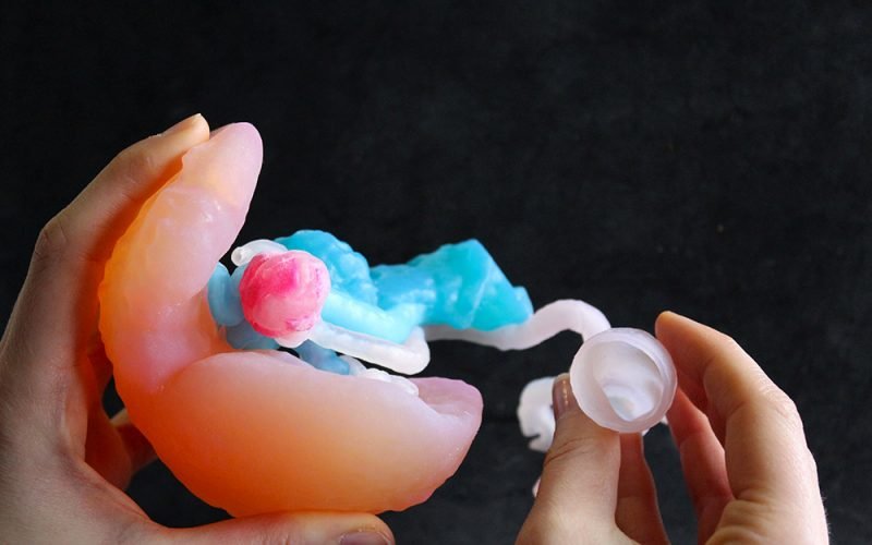 Abdominal Surgery » 3D4MED