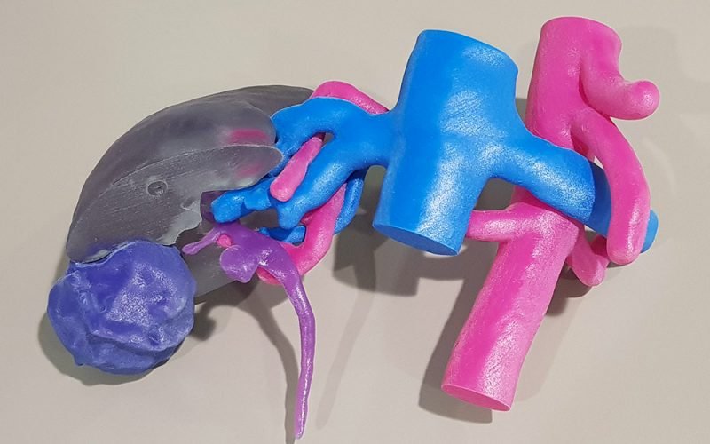 Abdominal Surgery » 3D4MED