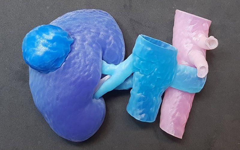 Abdominal Surgery » 3D4MED